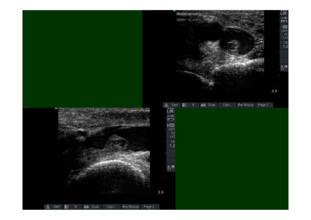 Point of Care USG in ICU.pdf
