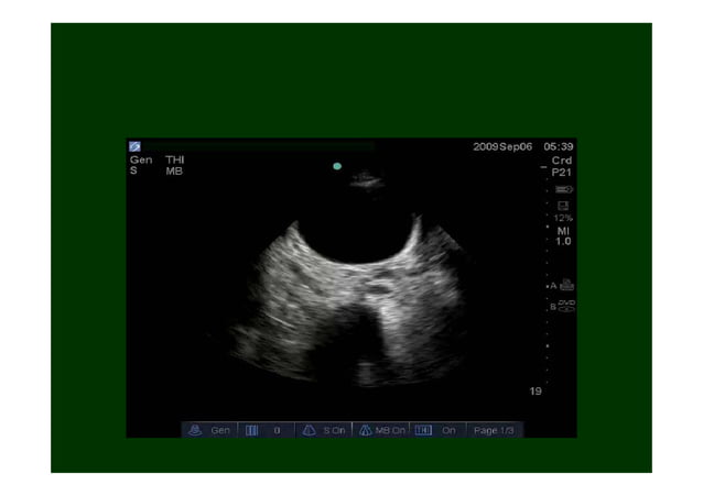 Point of Care USG in ICU.pdf