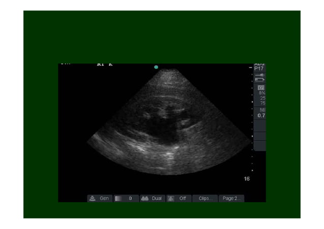 Point of Care USG in ICU.pdf