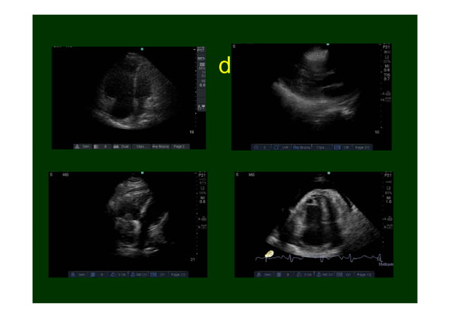 Point of Care USG in ICU.pdf