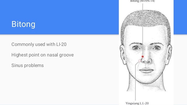 AcuPoints iii, midterm ii