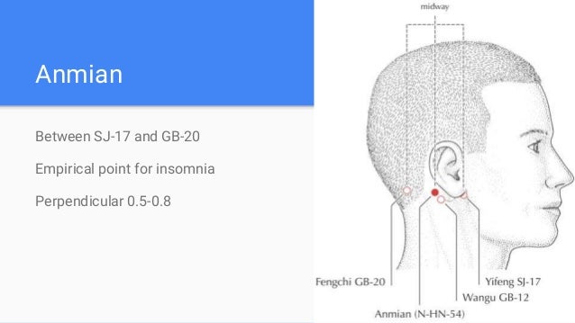 AcuPoints iii, midterm ii