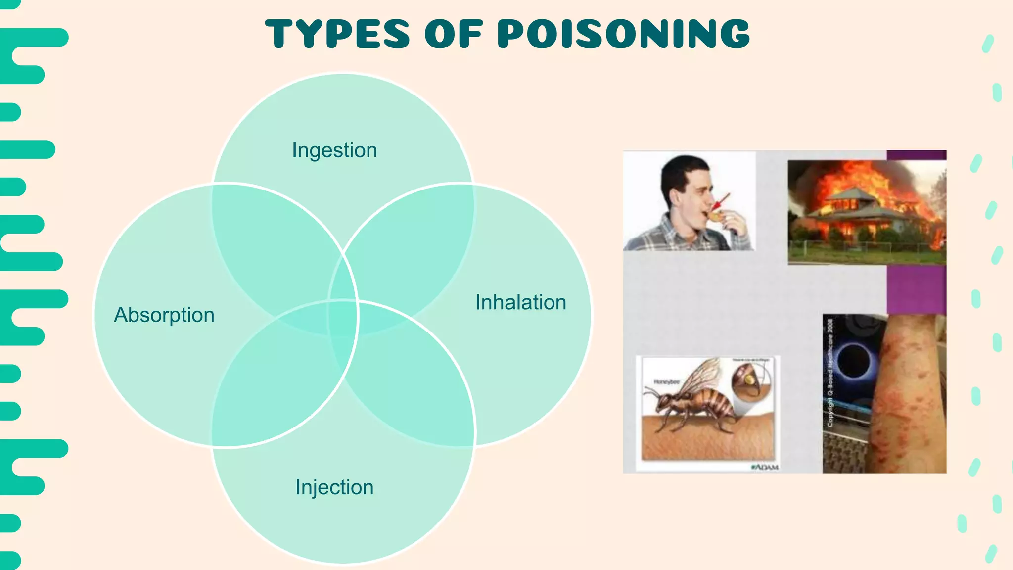Poisoning | PPTX