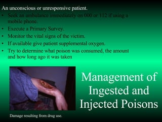 Poison | PPT | First Aid | Injuries