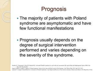 Poland Syndrome | PPTX