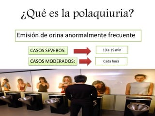 Polaquiuria y disuria | PPTX