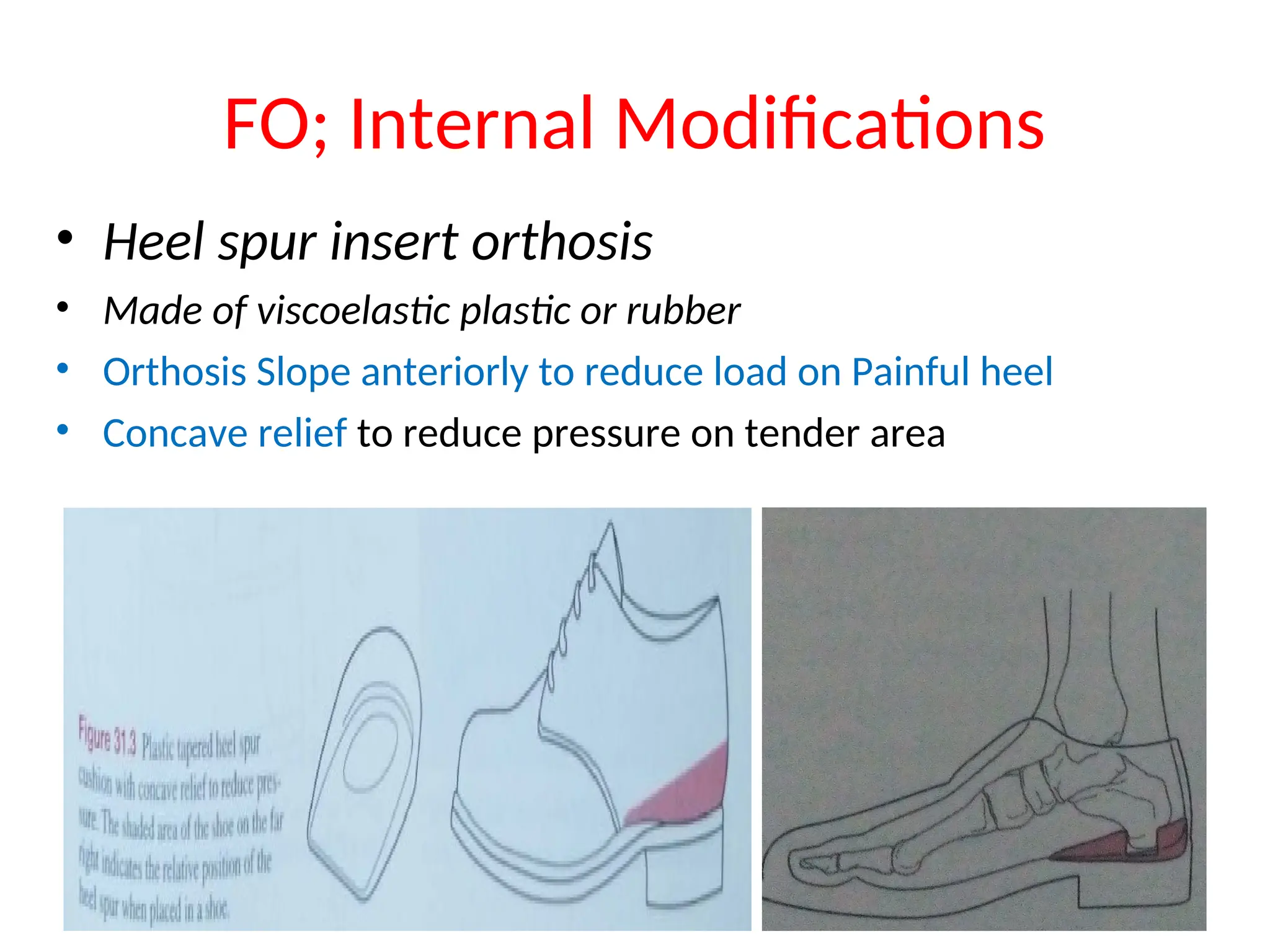 Introduction Foot Orthosis complete lecture .ppt