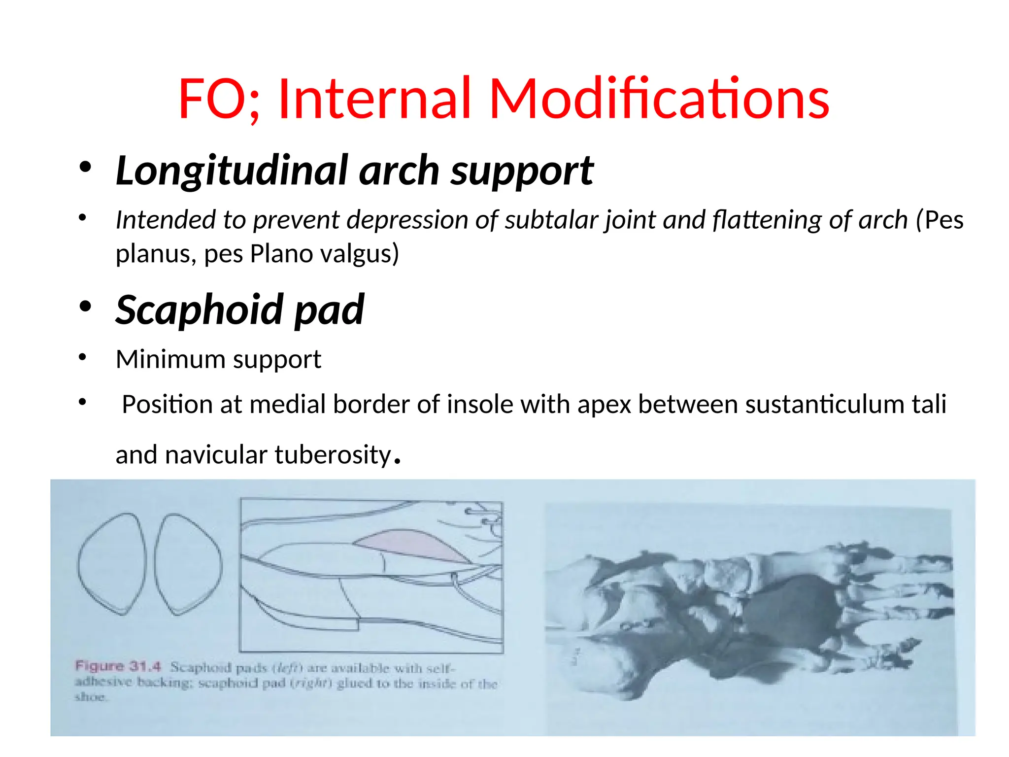 Introduction Foot Orthosis complete lecture .ppt