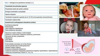 poliglobulia neonatal.pptx