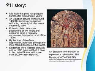 Polio | PPT
