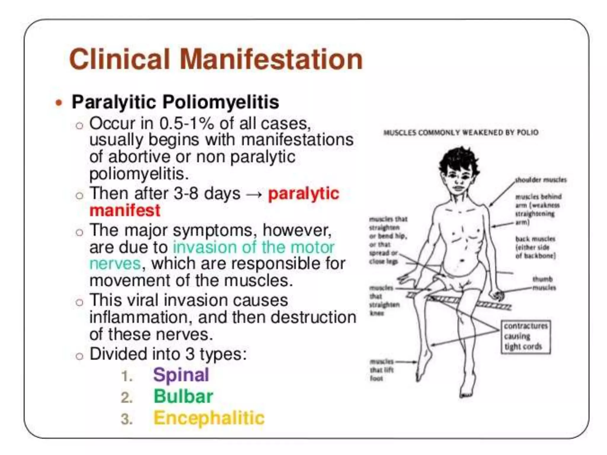 Polio virus notes for MLT students | PPTX
