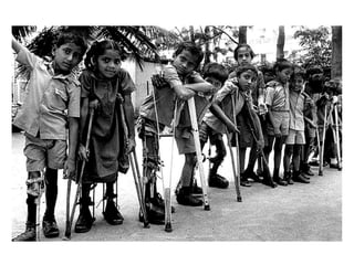 Polio virus notes for MLT students | PPT