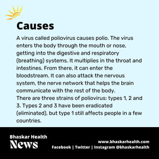 Polio (Poliomyelitis): Physiotherapy Treatment | PDF