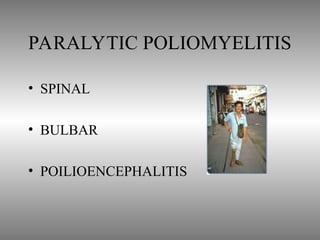 The clinical features and manifestations of of poliomyelitis | PPT