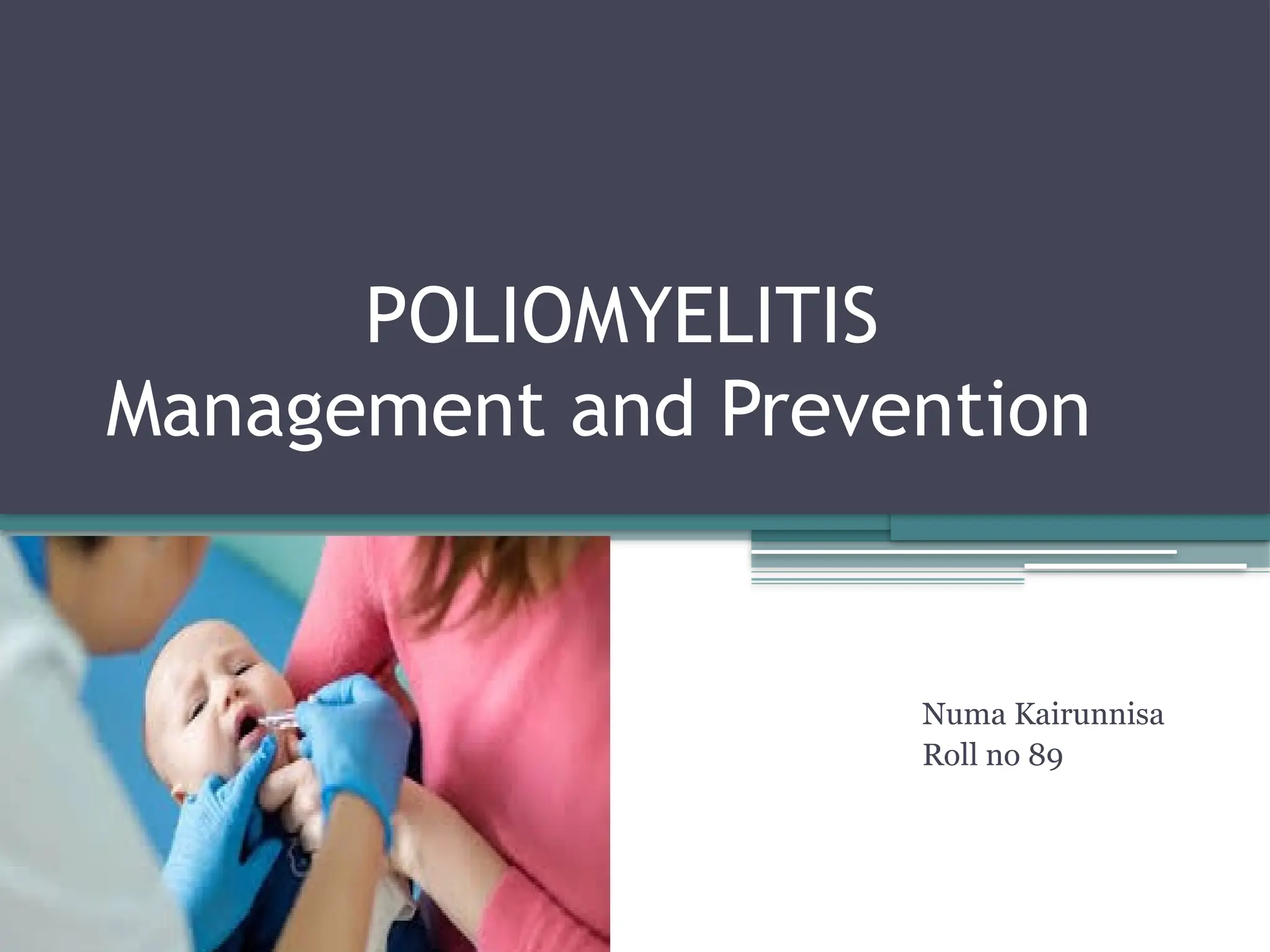 poliomyelitis management and treatment ppt | PPT