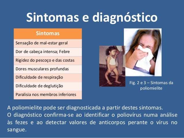Poliovirus Sintomas