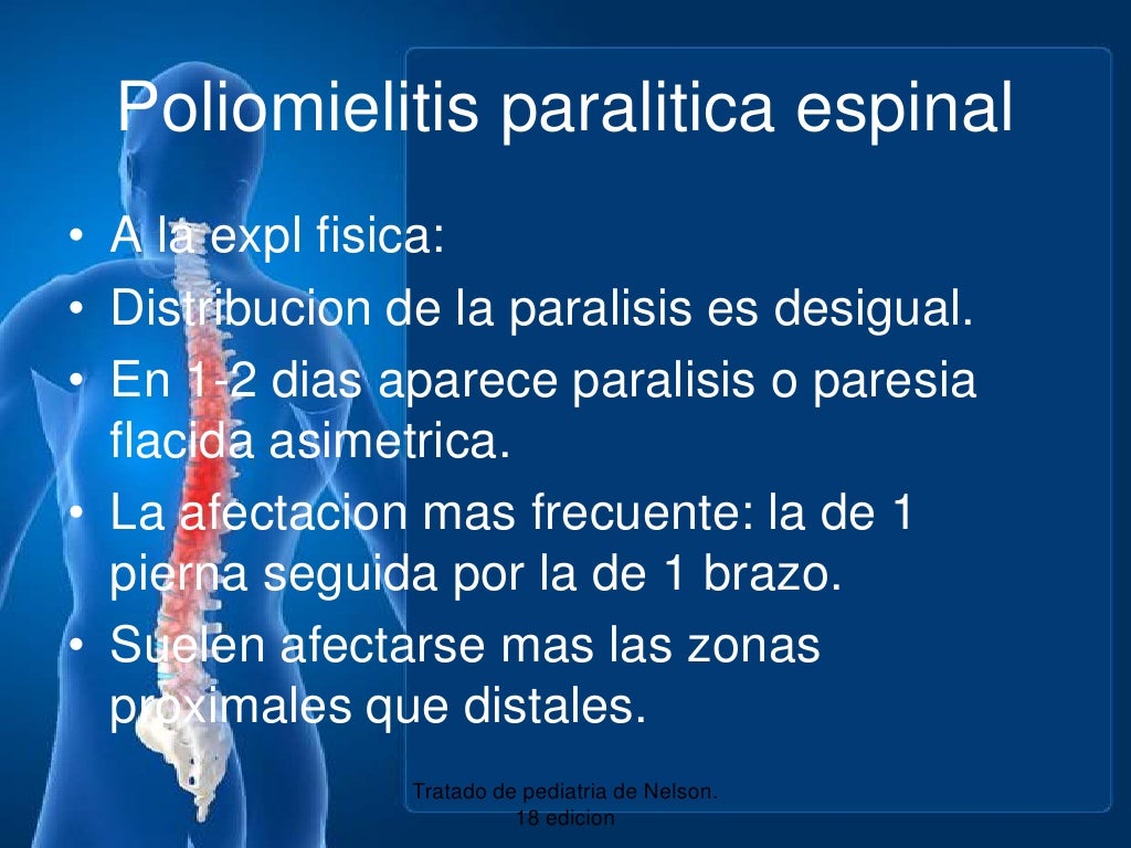 Poliomielitis Causas Sntomastratamiento Consecuencias