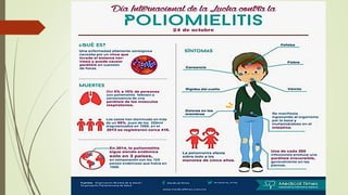 Poliomielitis | PPTX