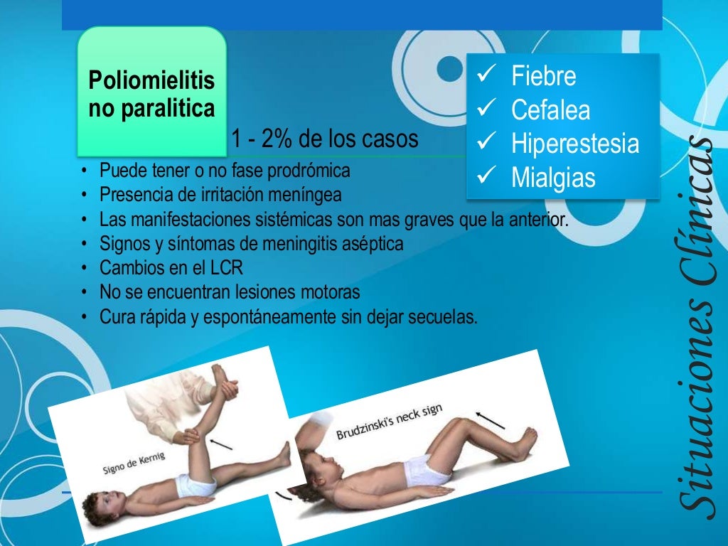 Poliomielitis Causas Sntomas Y Tratamiento