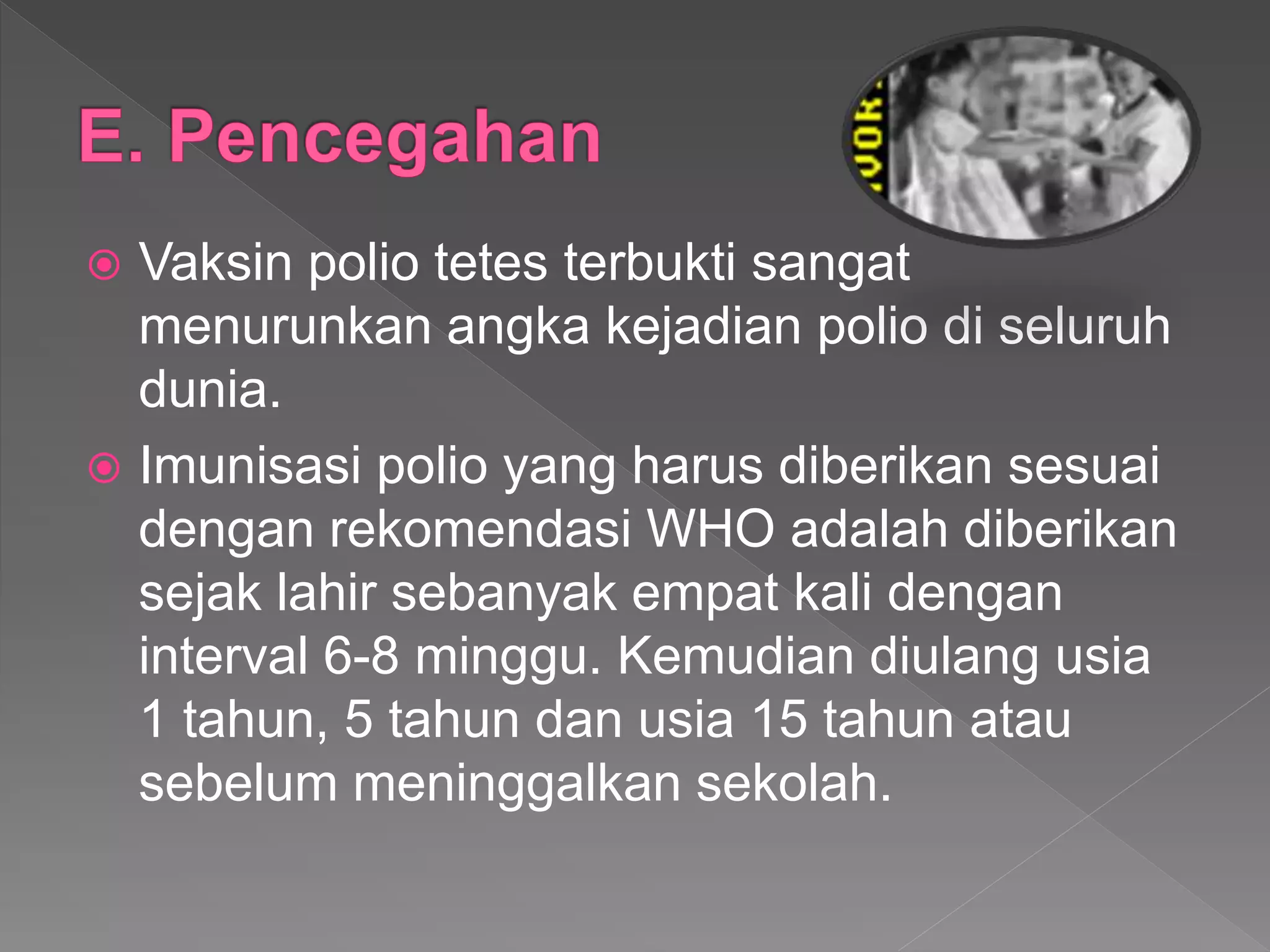 POLIOMIELITIS_PP (1).ppt