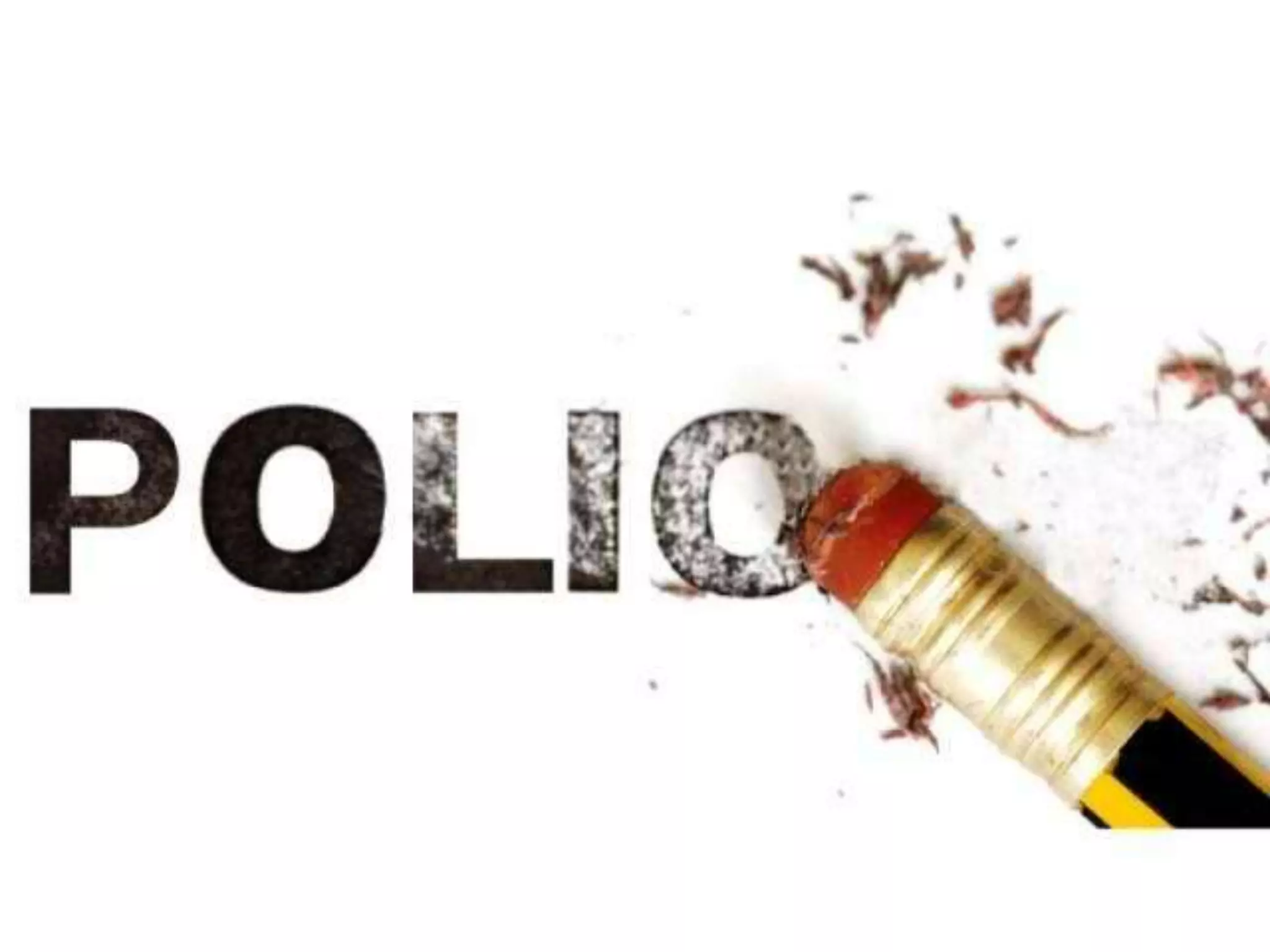 Poliomyelitis | PPTX