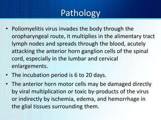 Poliomyelitis | PPTX