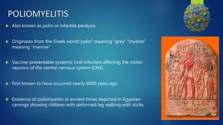 Poliomyelitis | PPTX