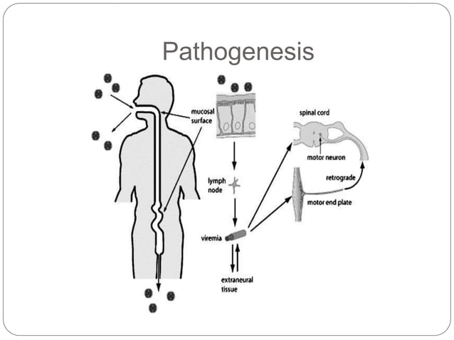 Poliomyelitis | PPTX | Lung and Respiratory Health | Diseases and ...