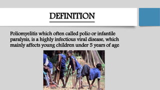 Poliomyelitis | PPTX