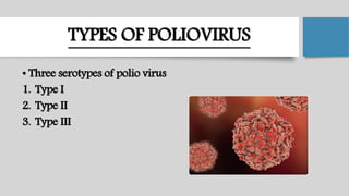 Poliomyelitis | PPTX