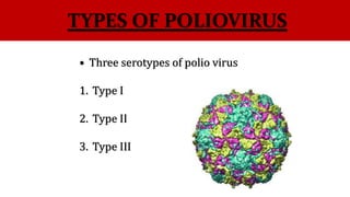 poliomyelitis-210118160100.pdf