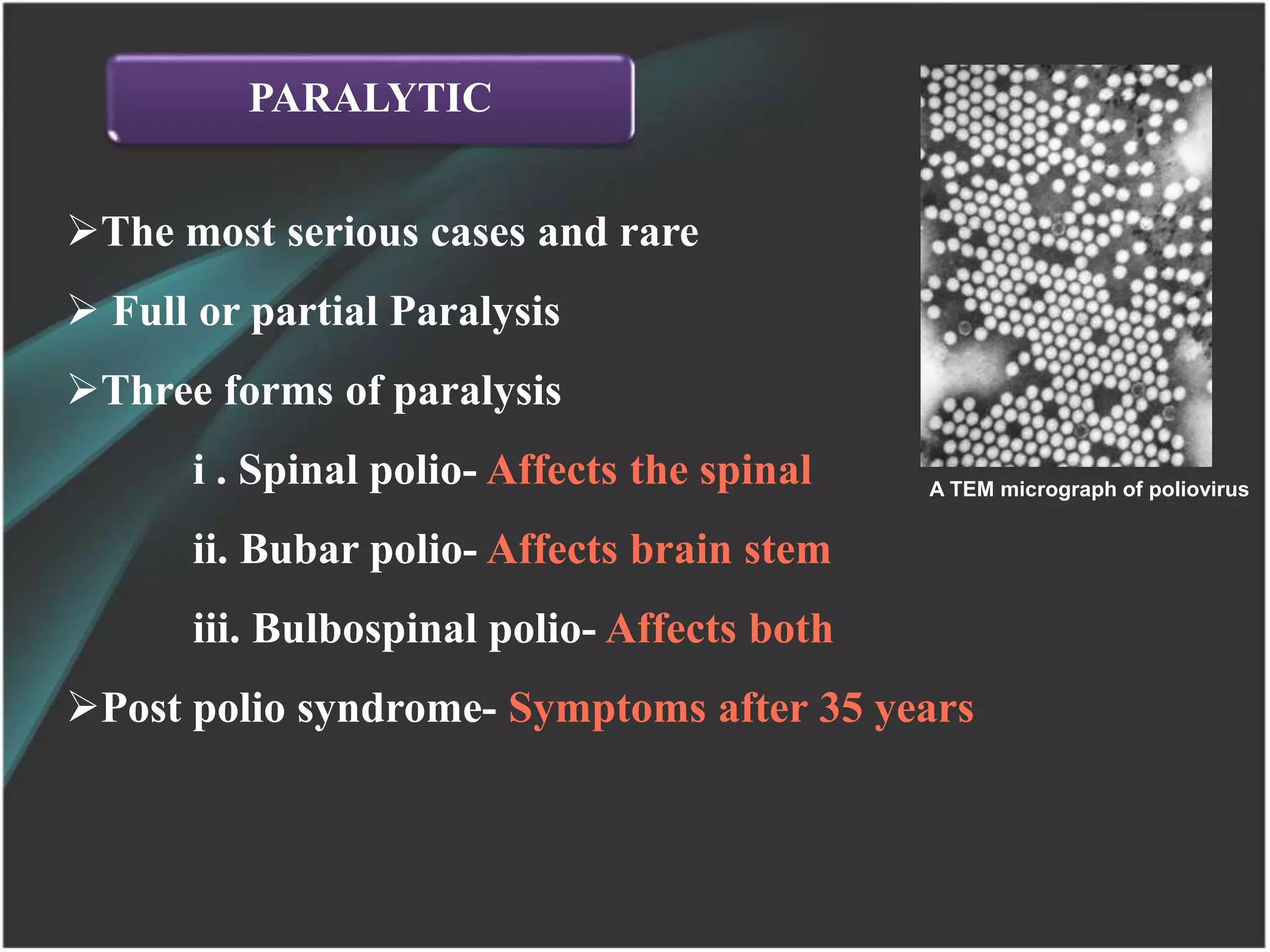 Poliomyelitis | PPTX