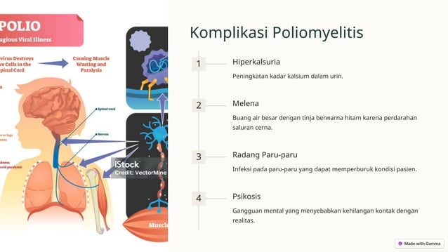 Poliomyelitis-Pemahaman-Pencegahan-dan-Perawatan.pptx