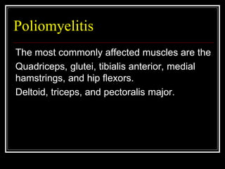 poliomyelitis1.ppt. . | PPT