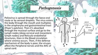 Poliomyelitis (Details with Physiotherapy management) | PPTX ...