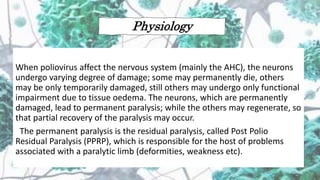 Poliomyelitis (Details with Physiotherapy management) | PPTX