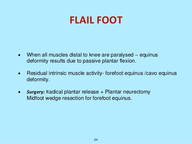 Poliomyelitis 3 ankle and foot