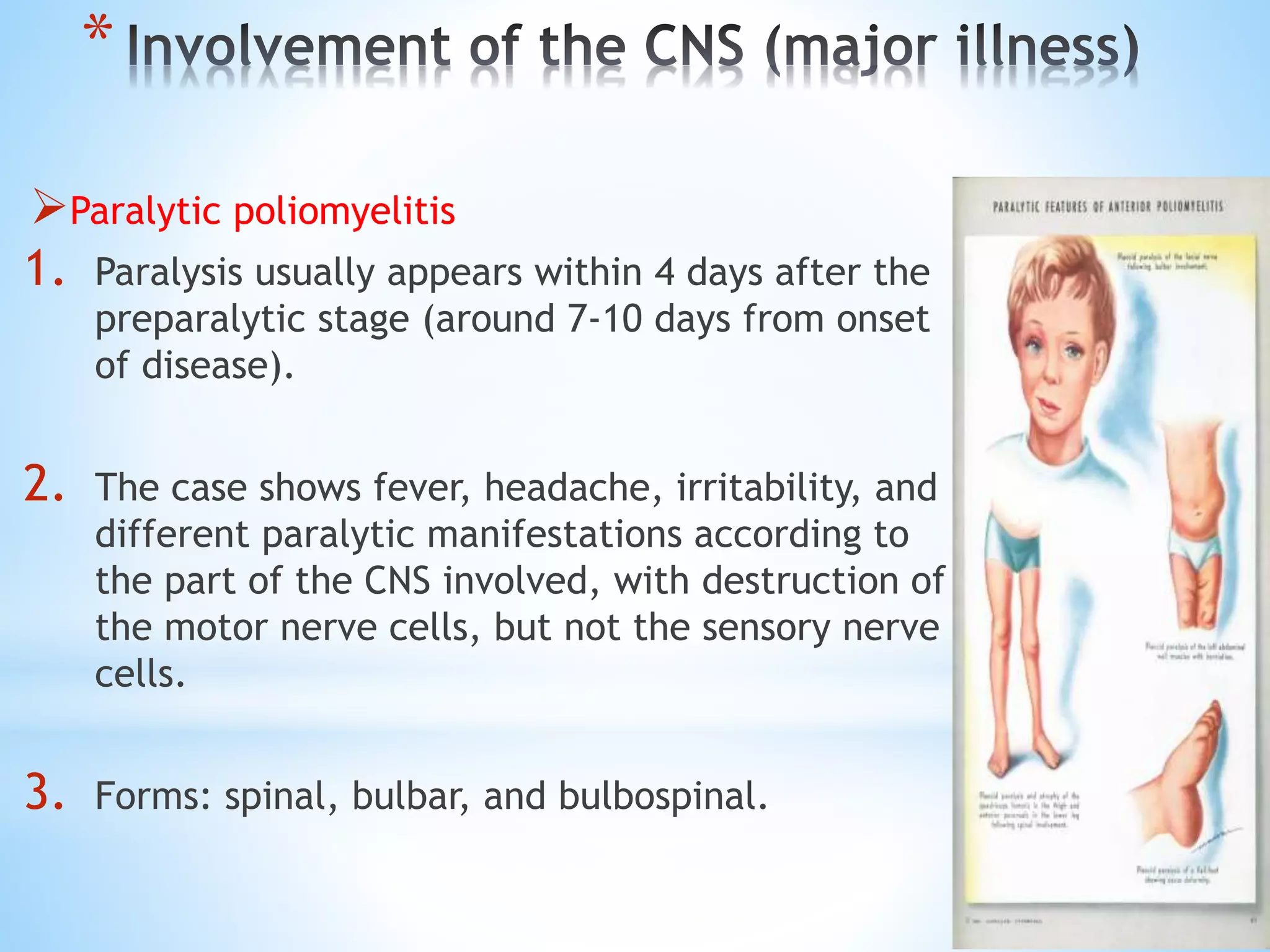 Poliomyelitis and post polio syndrome | PPTX