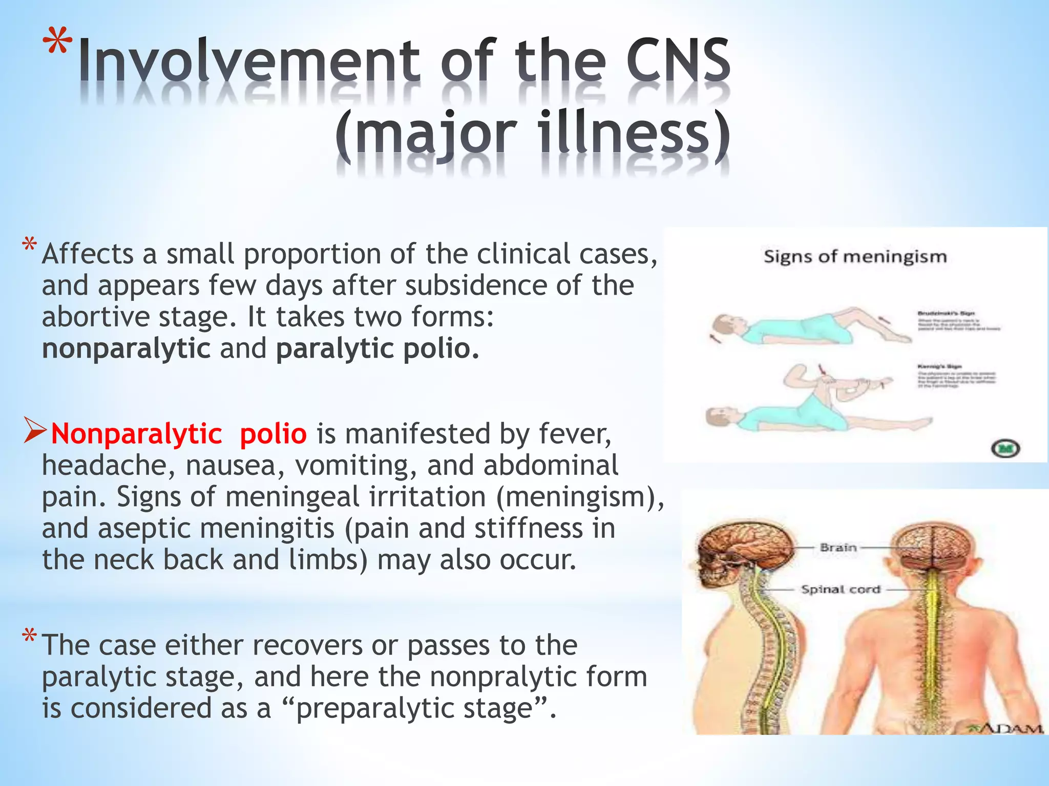 Poliomyelitis and post polio syndrome | PPTX