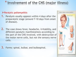 Poliomyelitis and post polio syndrome | PPTX