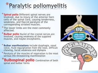 Poliomyelitis and post polio syndrome | PPTX