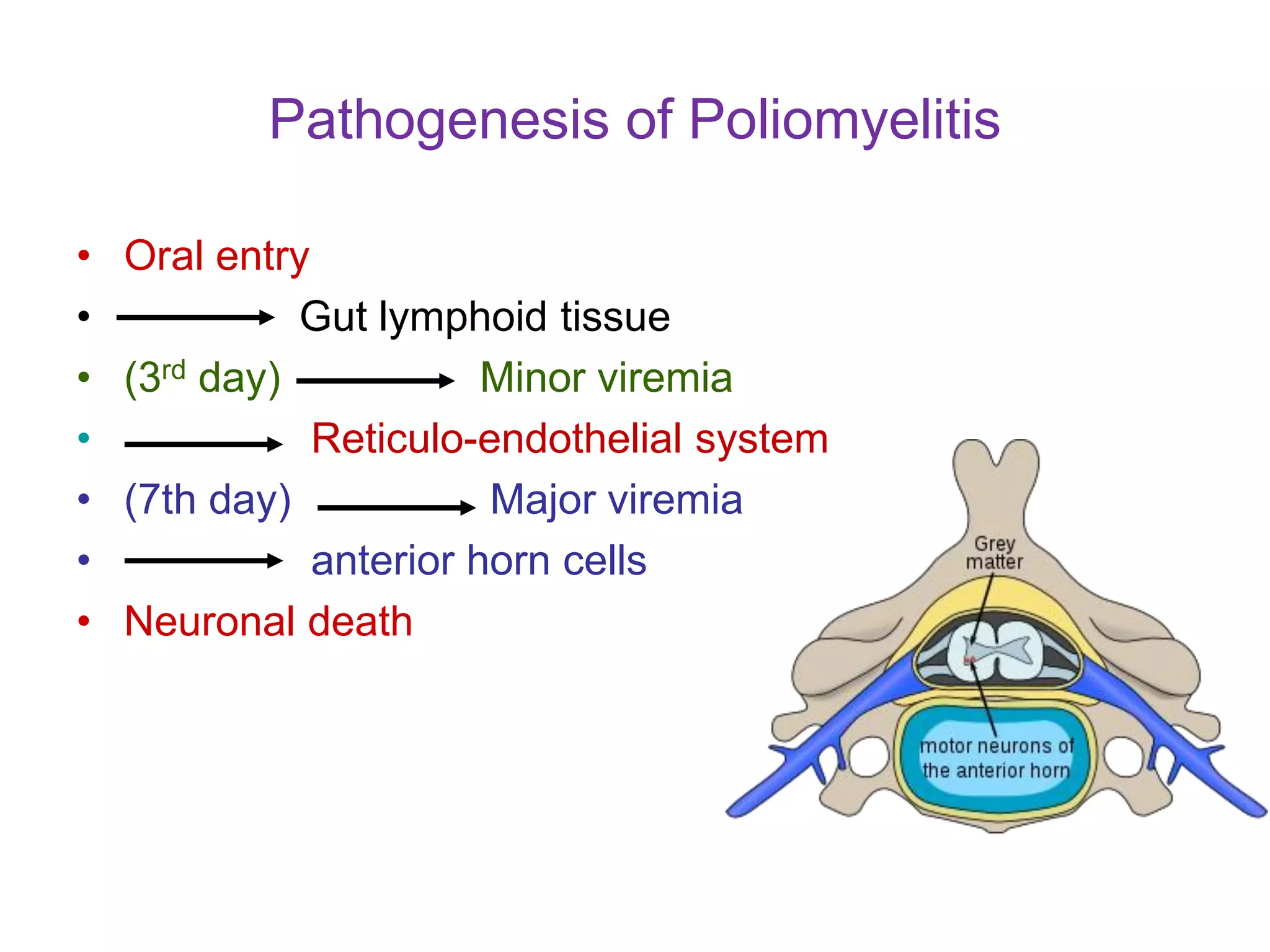 Poliomyelitis in children 2021 | PDF