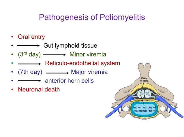Poliomyelitis in children 2021 | PDF