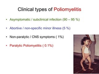 Poliomyelitis in children 2021 | PDF