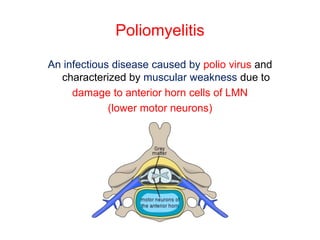 Poliomyelitis Spinal Cord