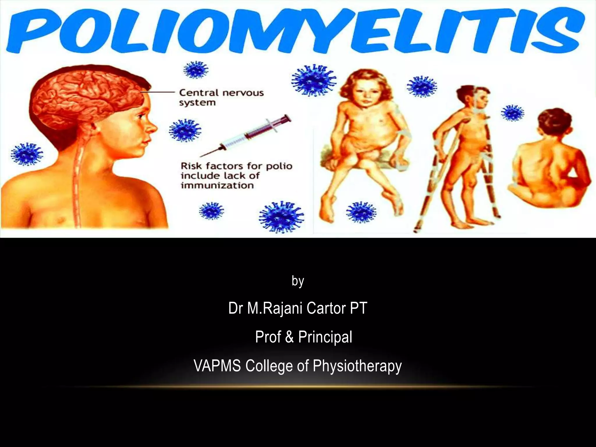 Poliomyelitis ortho pt | PPT