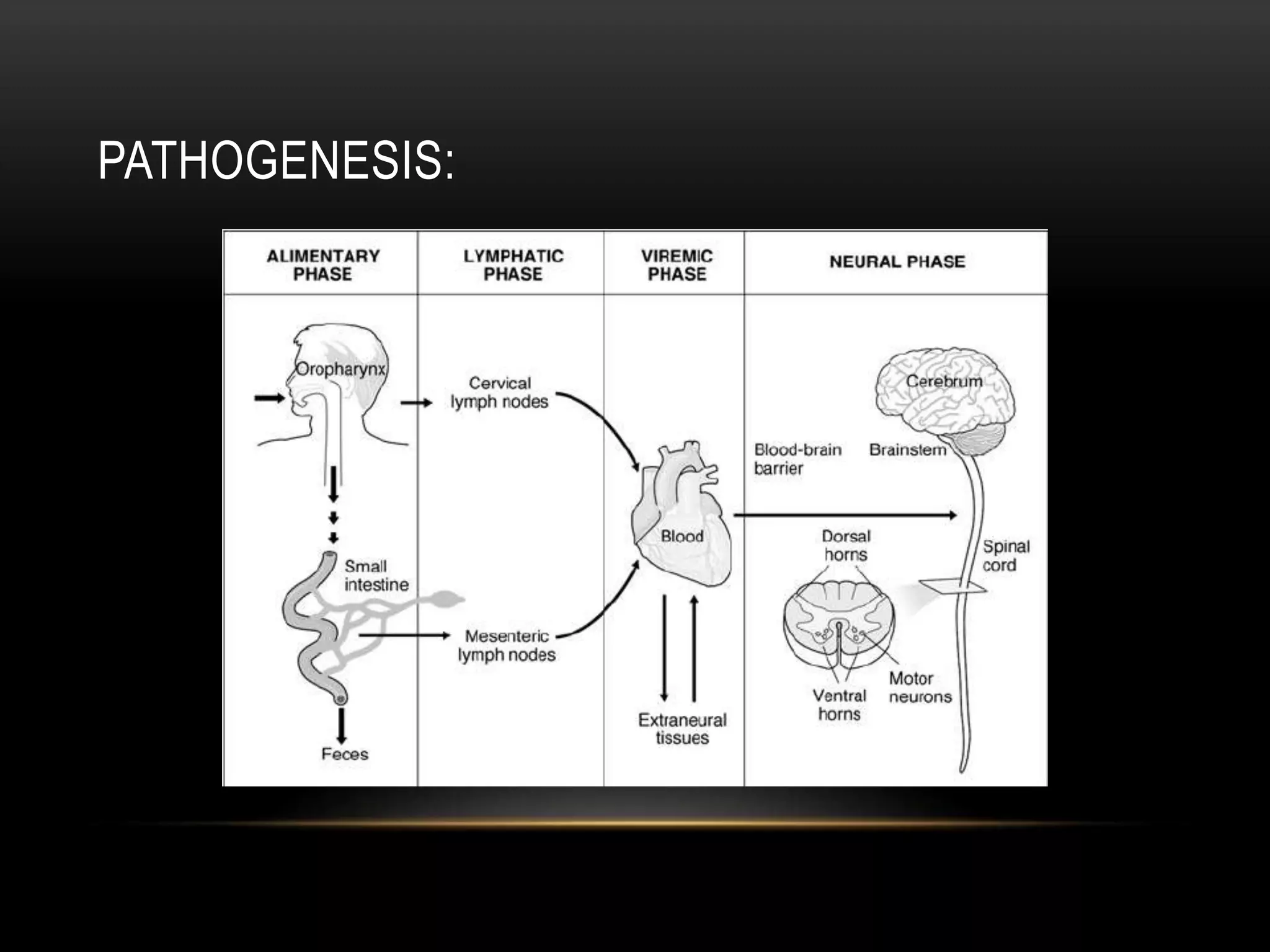 Poliomyelitis ortho pt | PPT