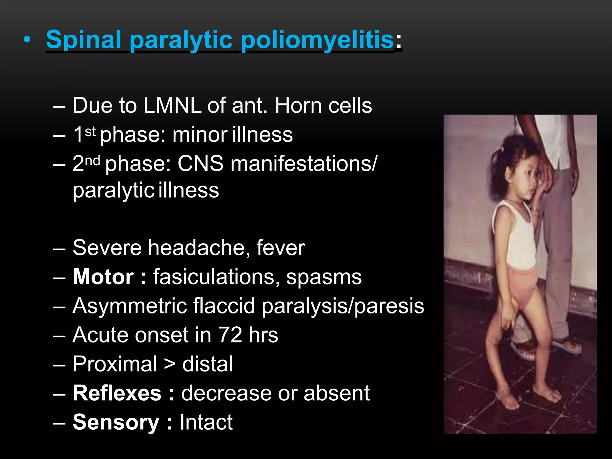 Poliomyelitis ortho pt | PPT