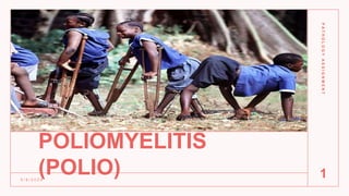 poliomyelitis pathology, causes, risk factors | PPTX