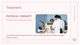 poliomyelitis pathology, causes, risk factors | PPTX